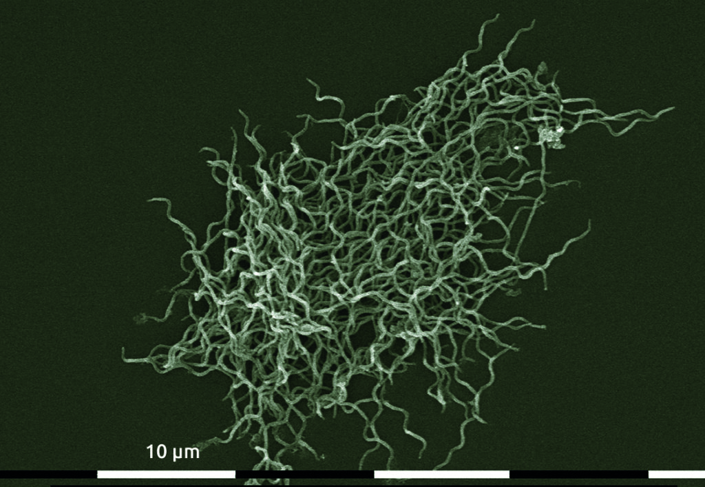The identification of Lyme borreliosis - Biowetenschappen & Maatschappij